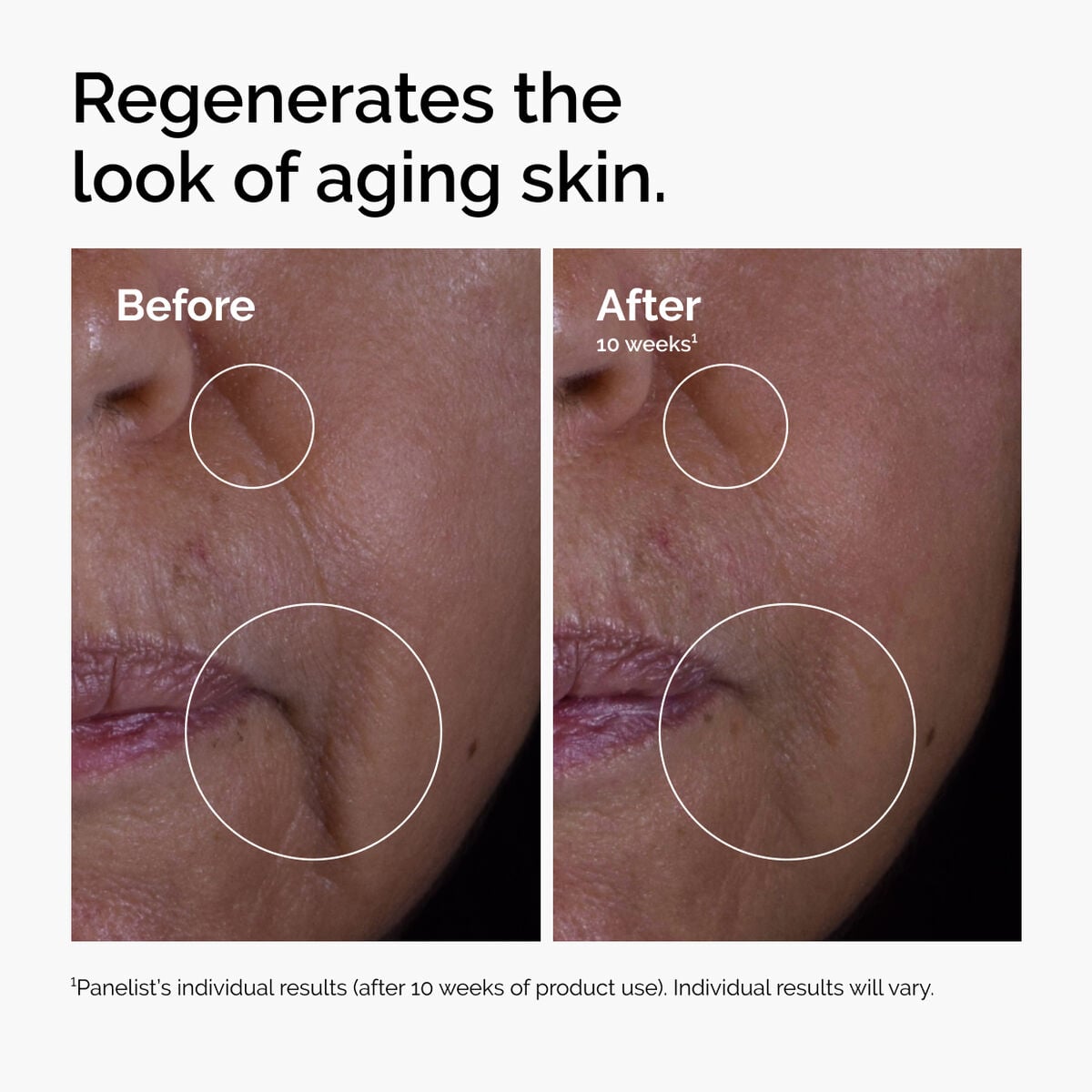 GF 15 Solution Growth Factor Serum The Ordinary gf-15-solution-growth-factor-serum-the-ordinary